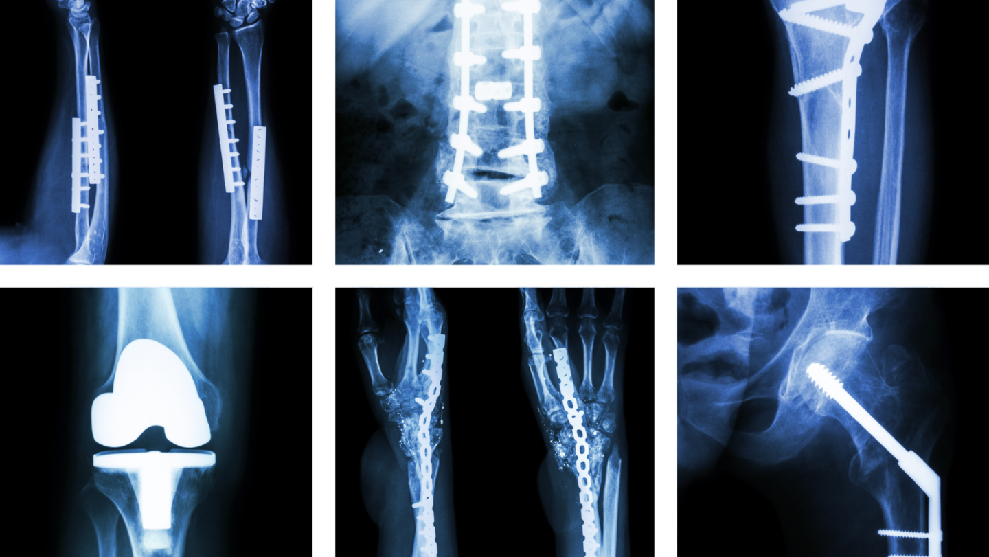 Orthopedic Imaging - Alabama