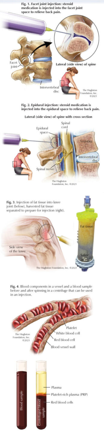 Interventional Pain Management: Questions for a Specialist - Alabama